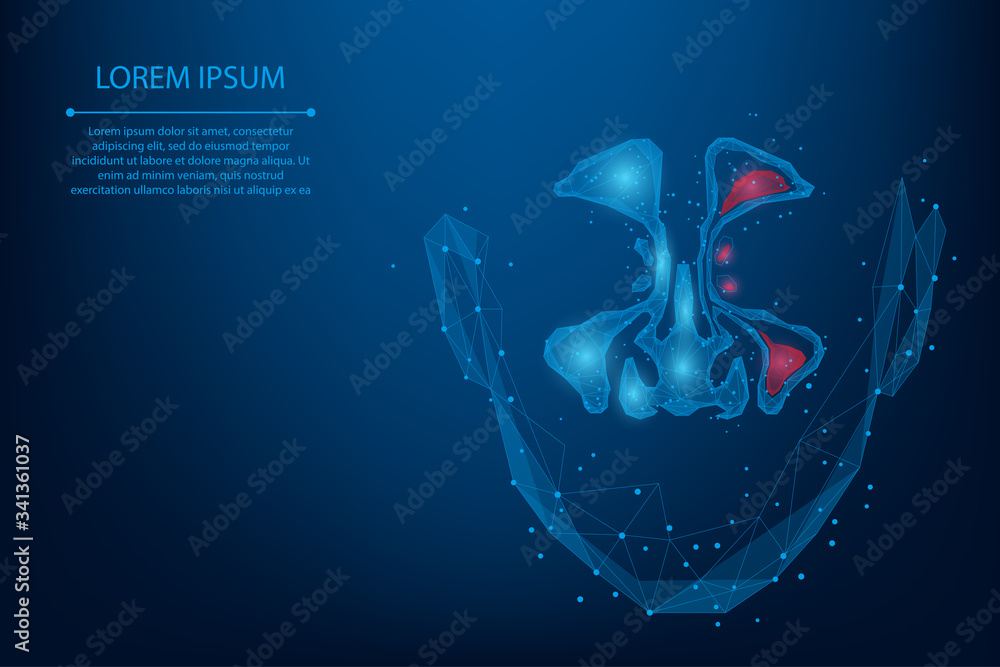 Abstract mesh line and point Sinusitis. Low poly Healthy and ...