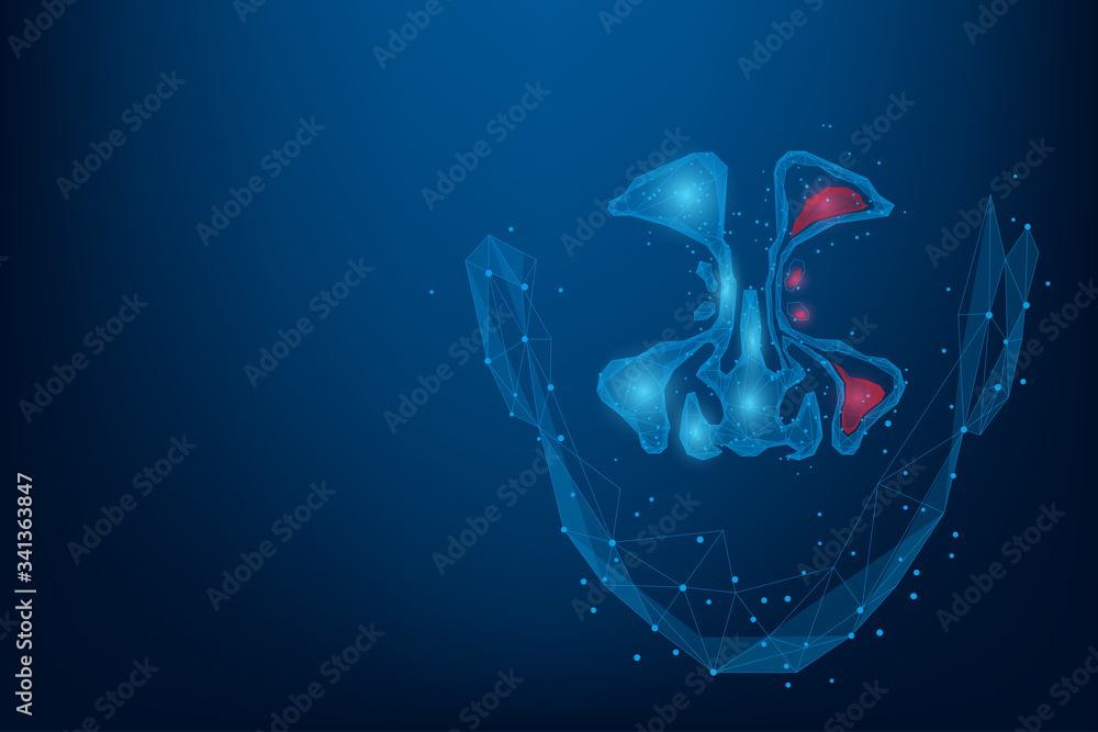 Abstract mesh line and point Sinusitis. Low poly Healthy and ...