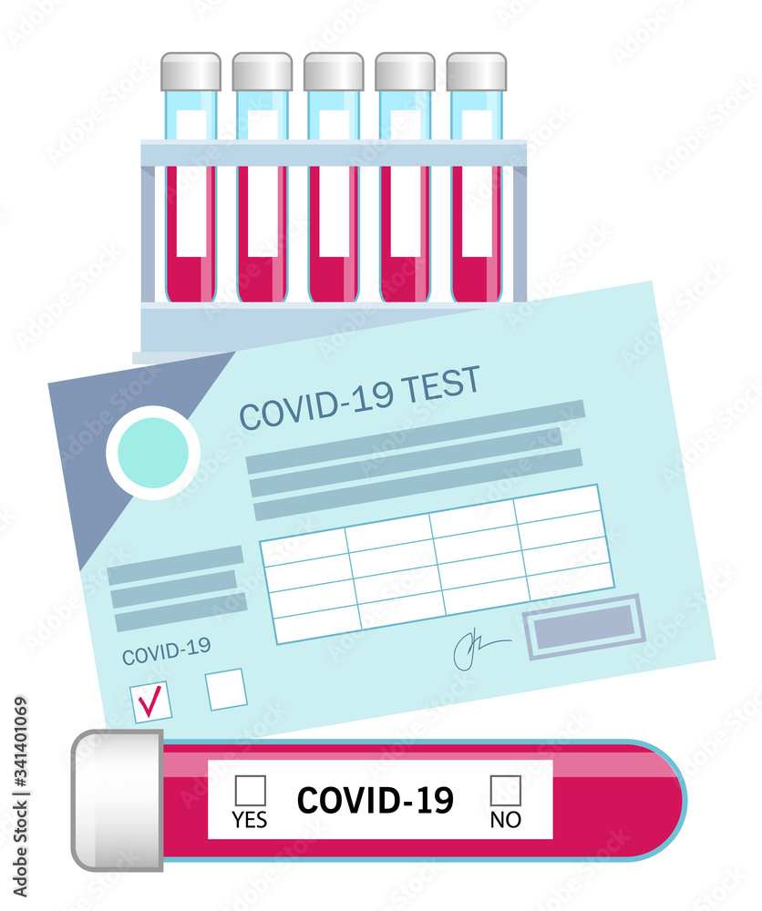Vector stock illustration. COVID-19 virus test result. Test tube ...
