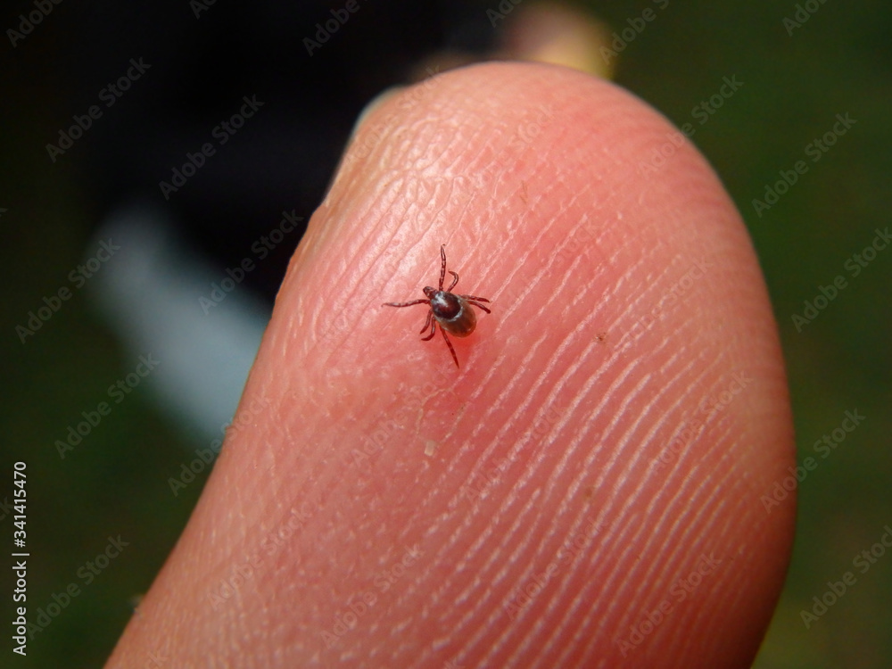 Small tick trying to bite n suck in middle of the forest in summer ...