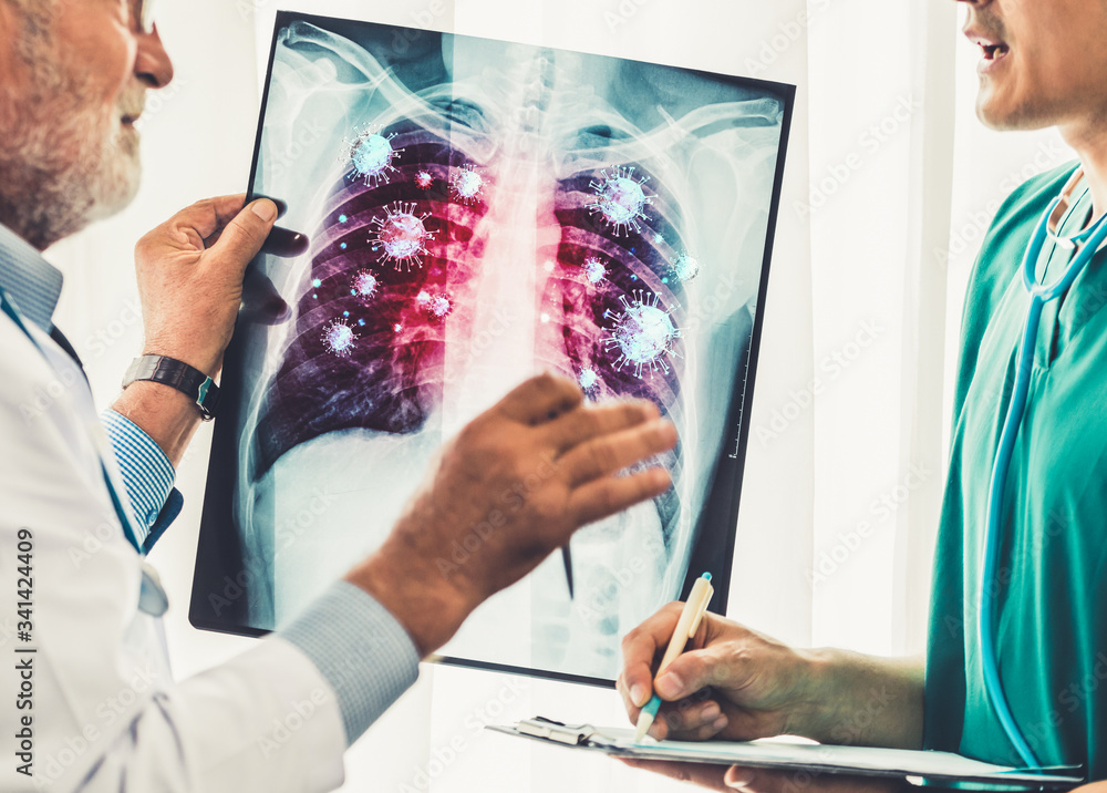 Doctor analyze Coronavirus Disease 2019 or Covid-19 displayed on x ray ...