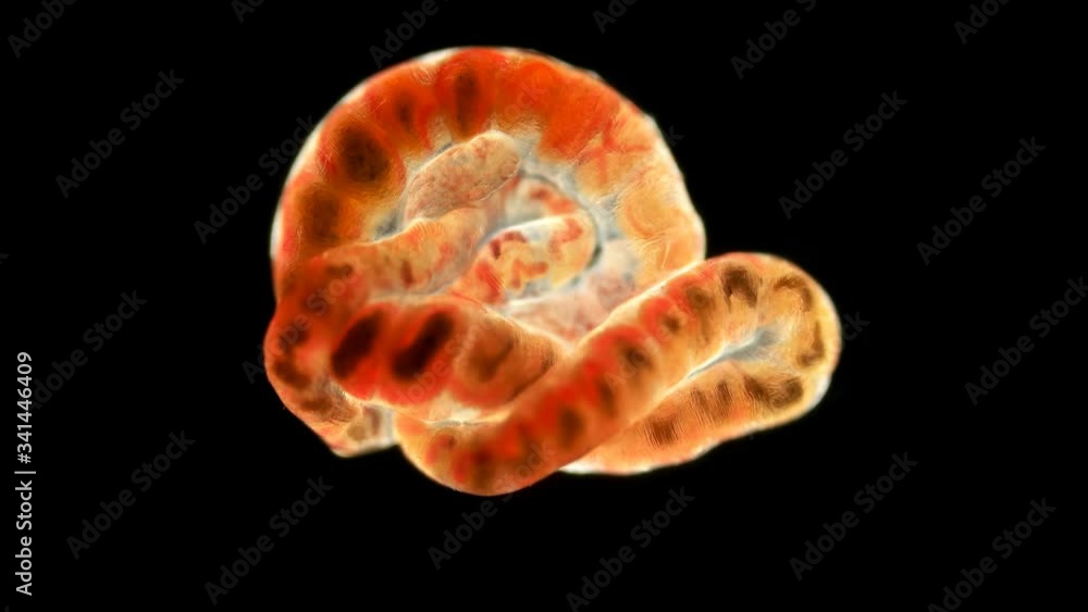 Tubifex worm under a microscope,Oligochaeta the Naididae family, type ...