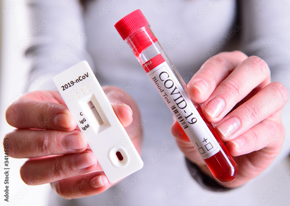 Rapid Covid-19 coronavirus strip test cassette for antibody or sars-cov ...