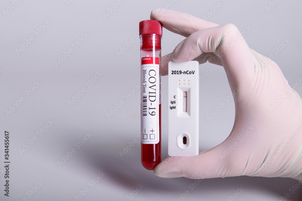 Rapid Covid-19 coronavirus strip test cassette for antibody or sars-cov ...