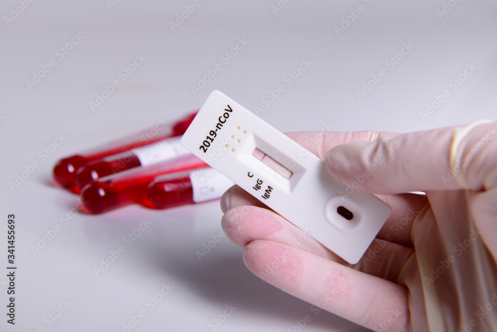 Rapid Covid-19 coronavirus strip test cassette for antibody or sars-cov ...