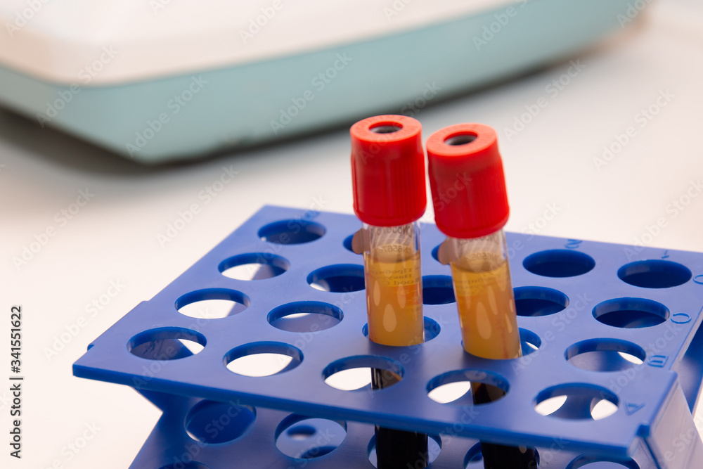 Two test-tubes with plazma in cells, prp laboratory Stock Photo | Adobe ...