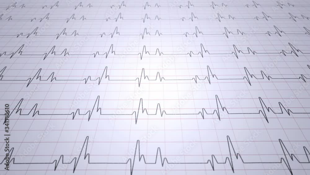 Medical EKG ECG Heart beat cardiogram background loop. You can use it ...