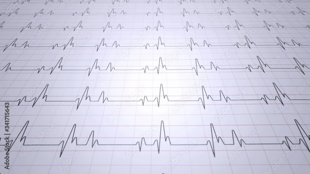 Medical EKG ECG Heart beat cardiogram background loop. You can use it ...