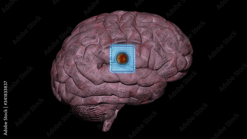 Microchip Implant inside human body , head , brain . 3d rendering ...