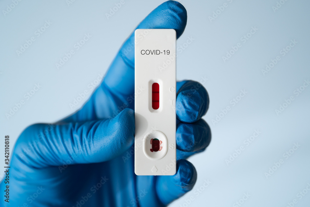 Doctor holding a test kit for viral disease COVID-19 2019-nCoV. Lab ...