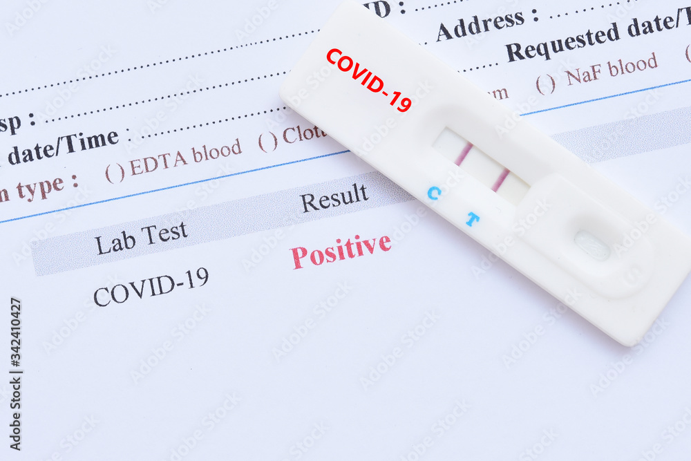 Positive test result by using rapid test device for COVID-19 virus ...