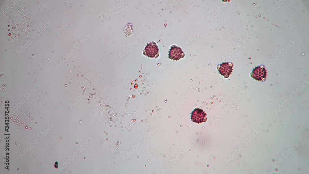 Video Stock Round spiked cells that look like a coronavirus covid-19 ...