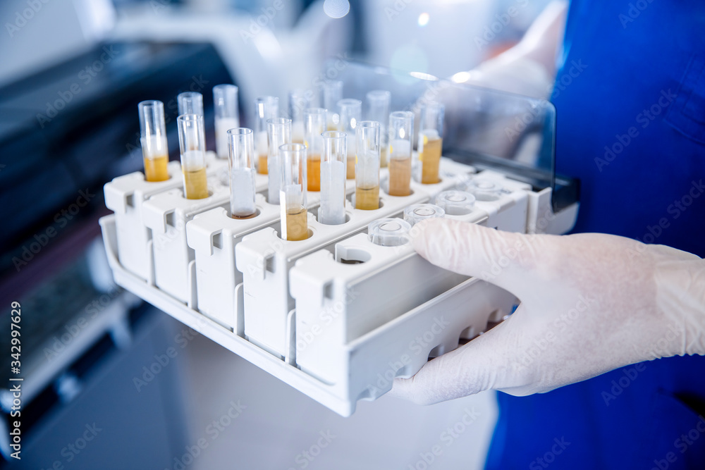 Express analysis of human urine in medical laboratory. Lab technician ...