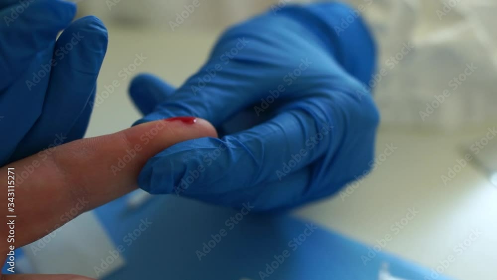 Rapid test covid 19. Serological blood test. Close-up blood sampling ...