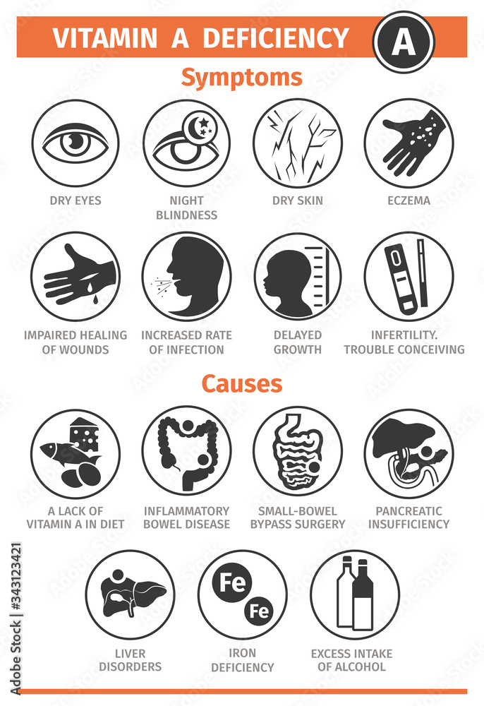 Symptoms and Causes of vitamin A deficiency. Template for use in ...