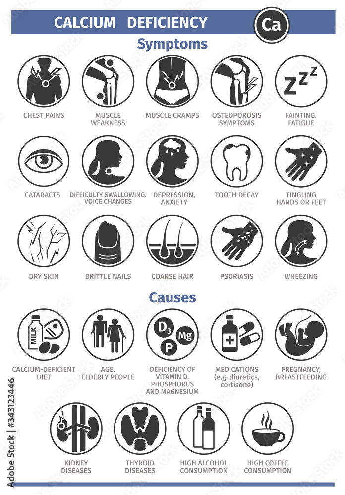 Poster Symptoms and Causes of Calcium deficiency – Wall Art | UkPosters