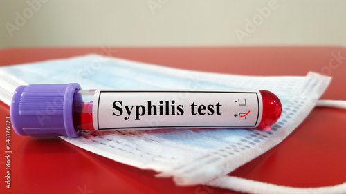 Positive Syphilis test and laboratory sample of blood testing for ...