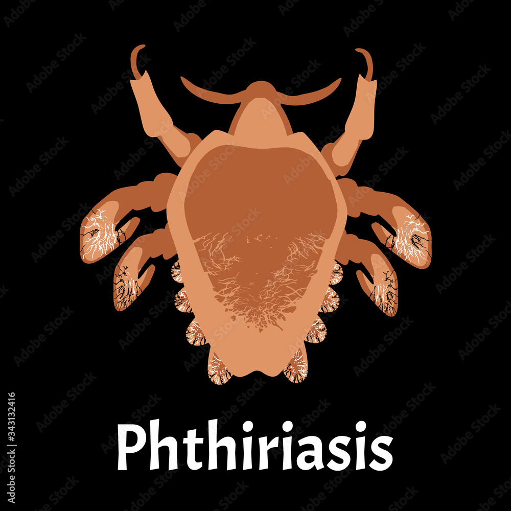 Parasitic diseases of Phthiriasis. Pediculosis pubis. Pubic lice ...