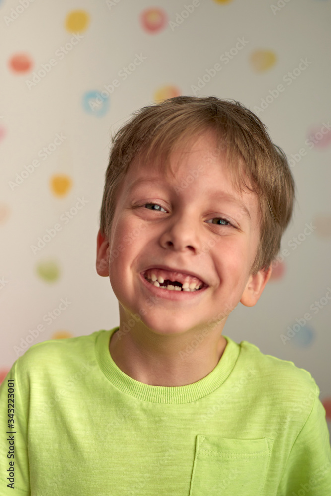 Kid showing missing teeth, he has lost two calfs teeth. Close up ...