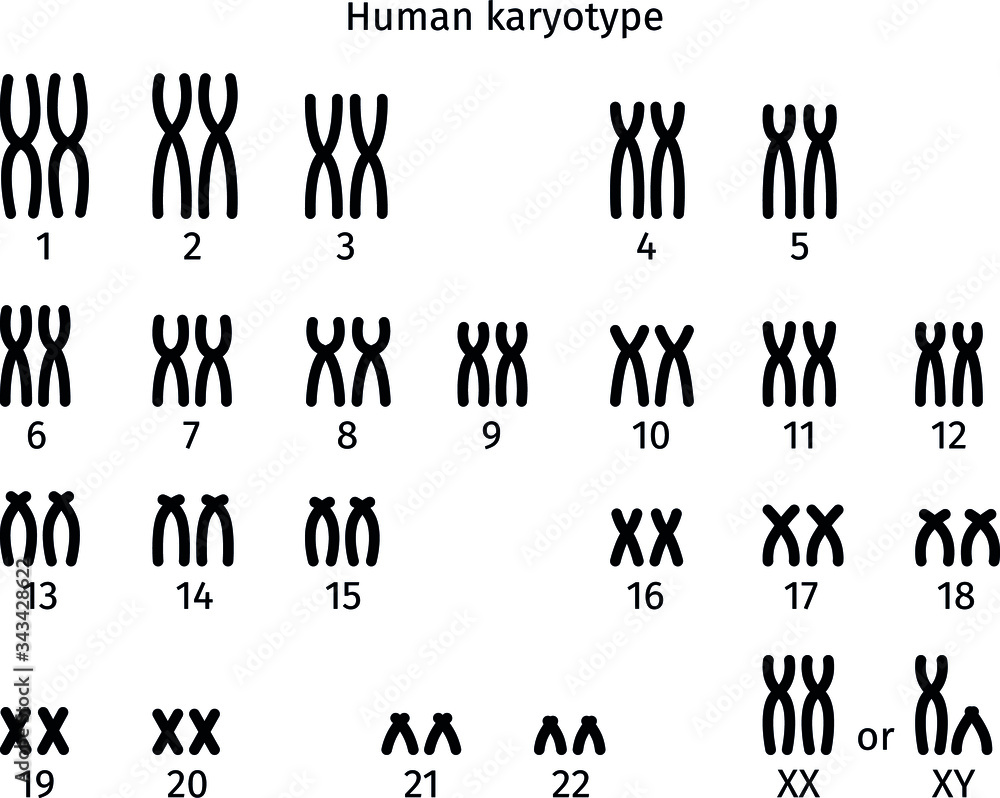 Vecteur Stock Scheme of normal karyotype of human somatic cell 46XX and ...