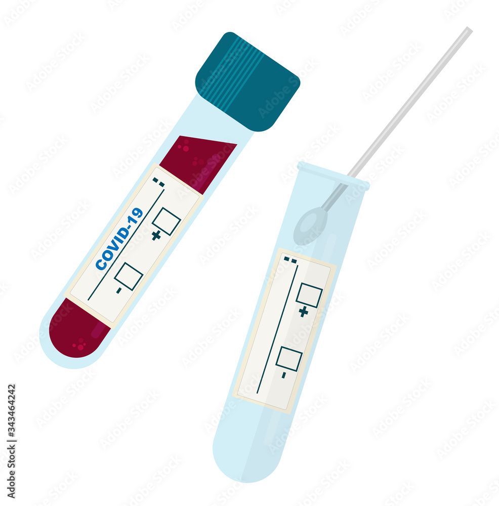 types of tests for coronavirus. vector illustration test tube with ...