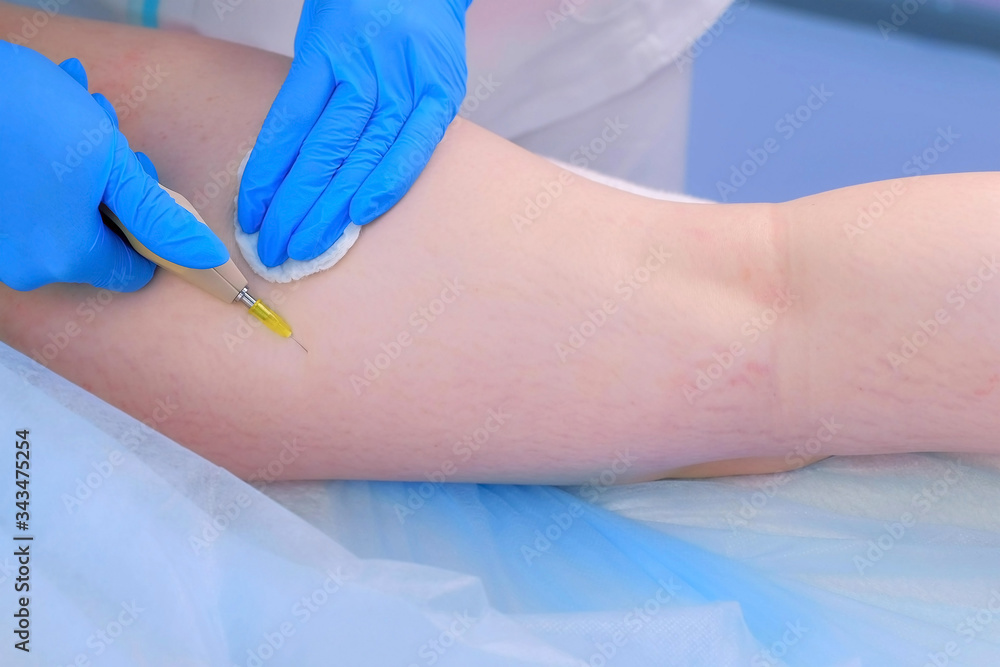 Doctor is making injection of carbon dioxide on patient's leg on ...