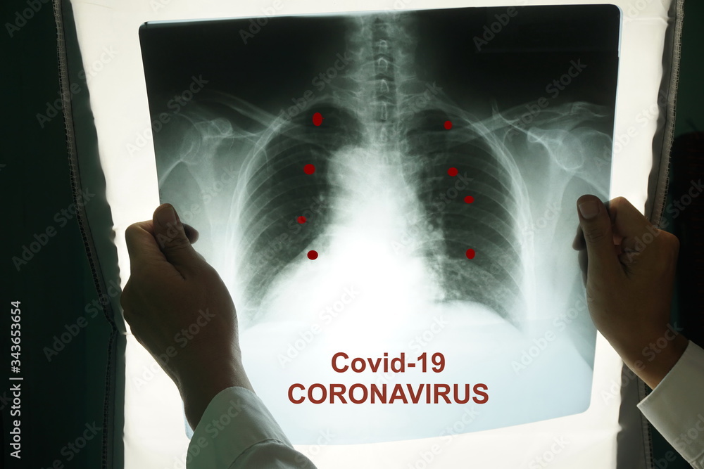 Covid-19 Coronavirus concept: Human X-Ray with wording Covid-19. World ...