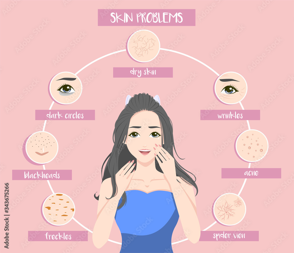 Female Face with skin problems vector illustration Stock Vector | Adobe ...