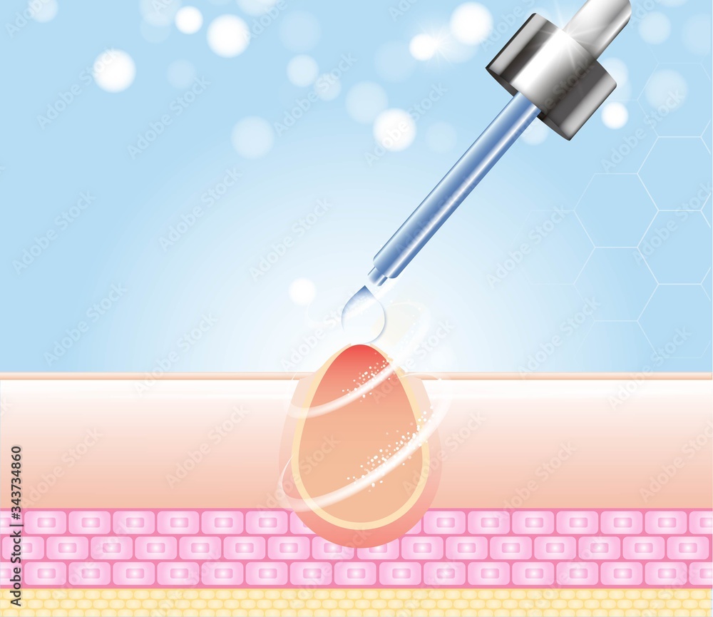 Three main layer of the human skin. skin aging stages diagrams, ollagen ...