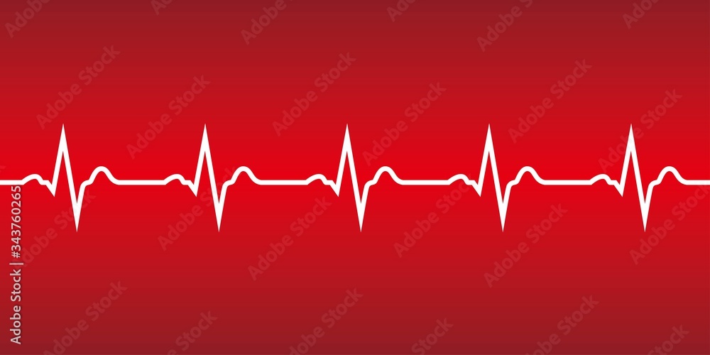 Graphic material representing an electrocardiogram Stock Illustration ...