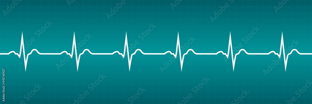 Graphic material representing an electrocardiogram Stock Vector | Adobe ...
