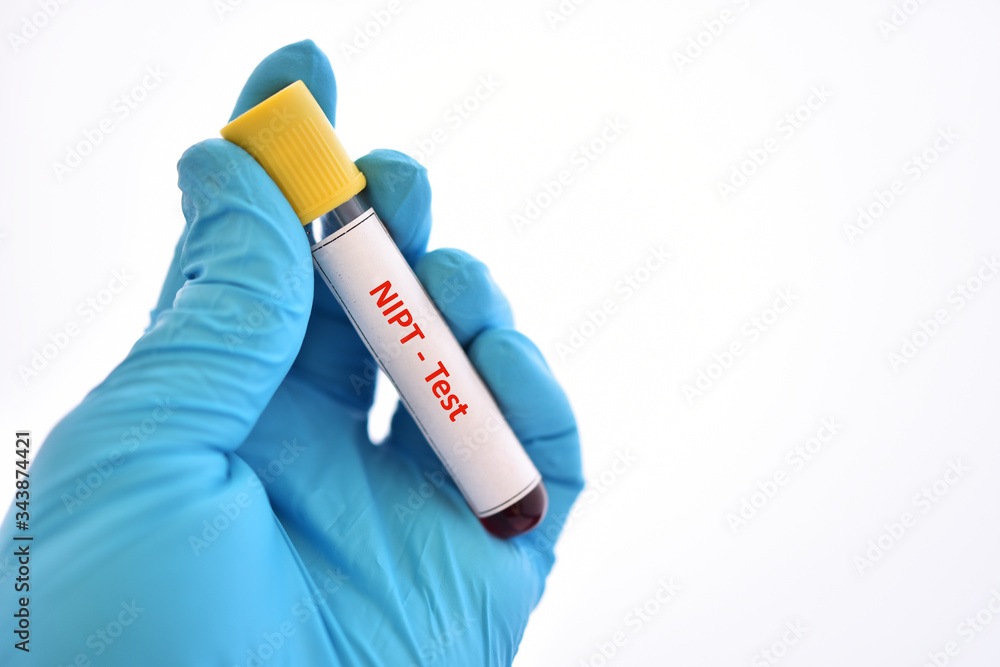 Blood sample tube for NIPT test or non-invasive prenatal testing ...