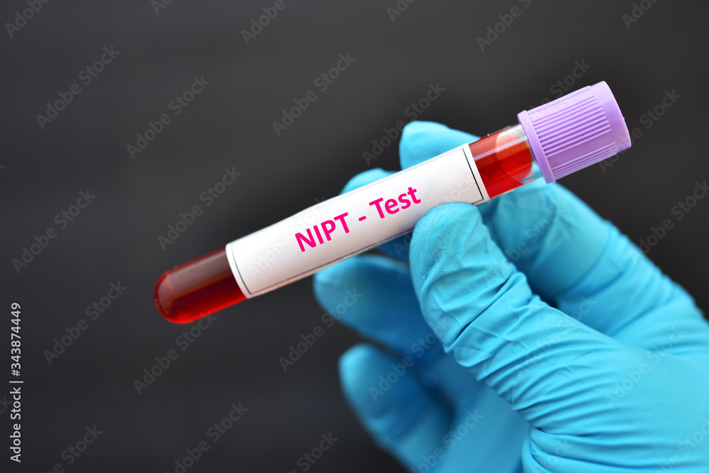 Blood sample tube for NIPT test or non-invasive prenatal testing ...