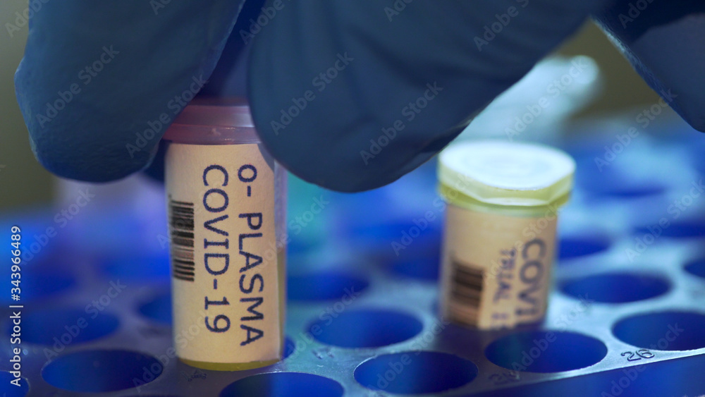 Macro scene of technician handling a small snap lock plastic vial in a ...