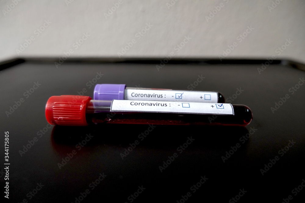 Professional doctors perform COVID-19 tests from samples of blood tests ...