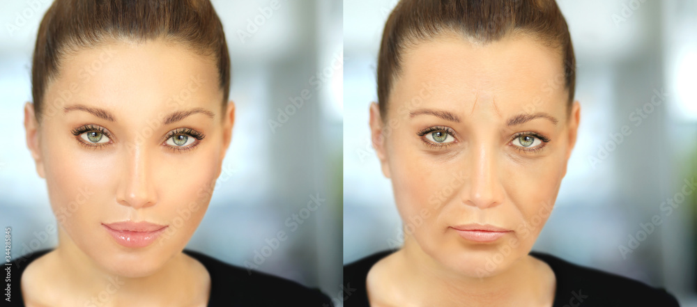 Aging. Mature woman-young woman.Face with skin problem.Showing photos ...