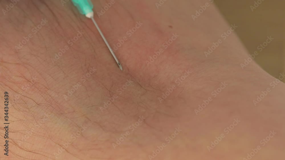 4K footage, A very close-up of a medical needle that sticks into a vein ...