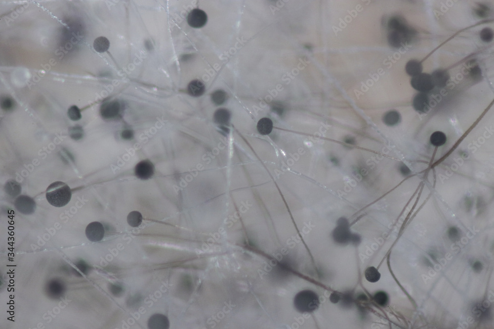 Backgrounds Colony Characteristics of Rhizopus (bread mold) is a genus ...