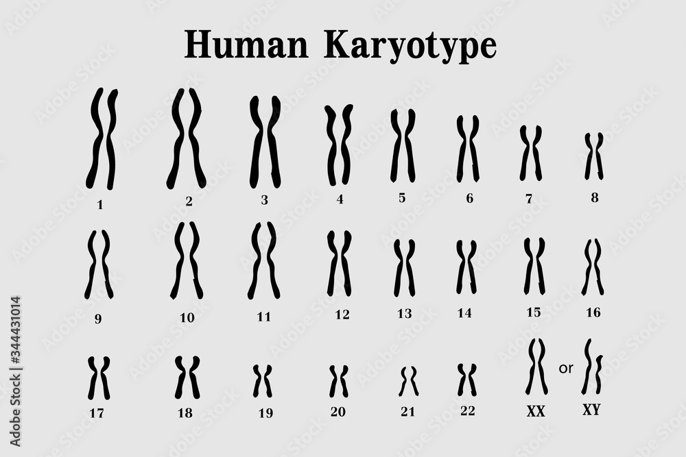 Karyotype of normal human chromosome illustration vector Stock Vector ...