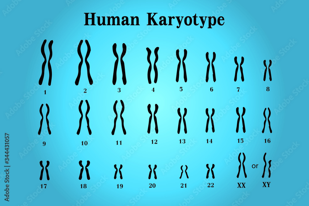 Human karyotype illustration. Human chromosome Stock Vector | Adobe Stock