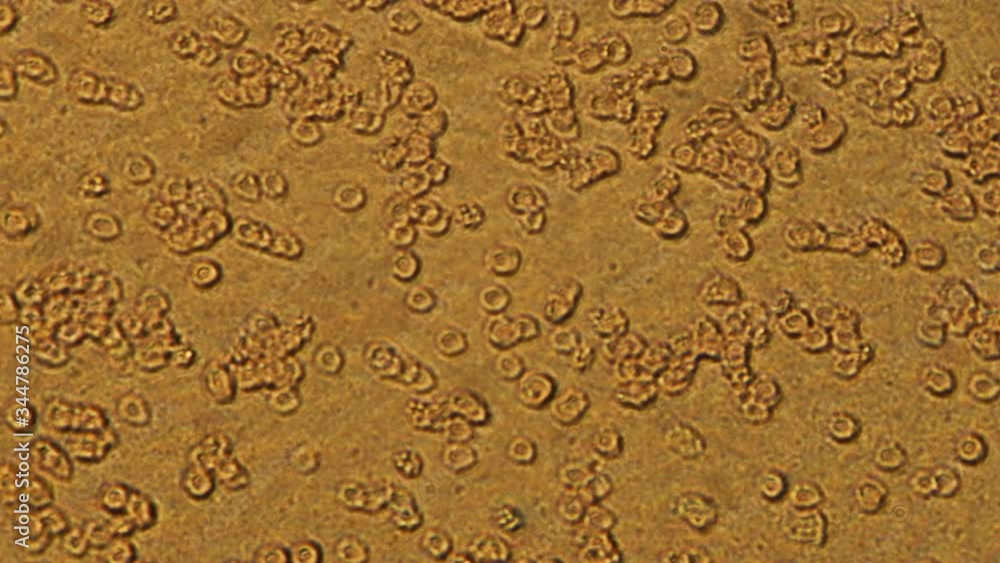 Microscopy of human blood cell test. Magnification 300x moving of red ...