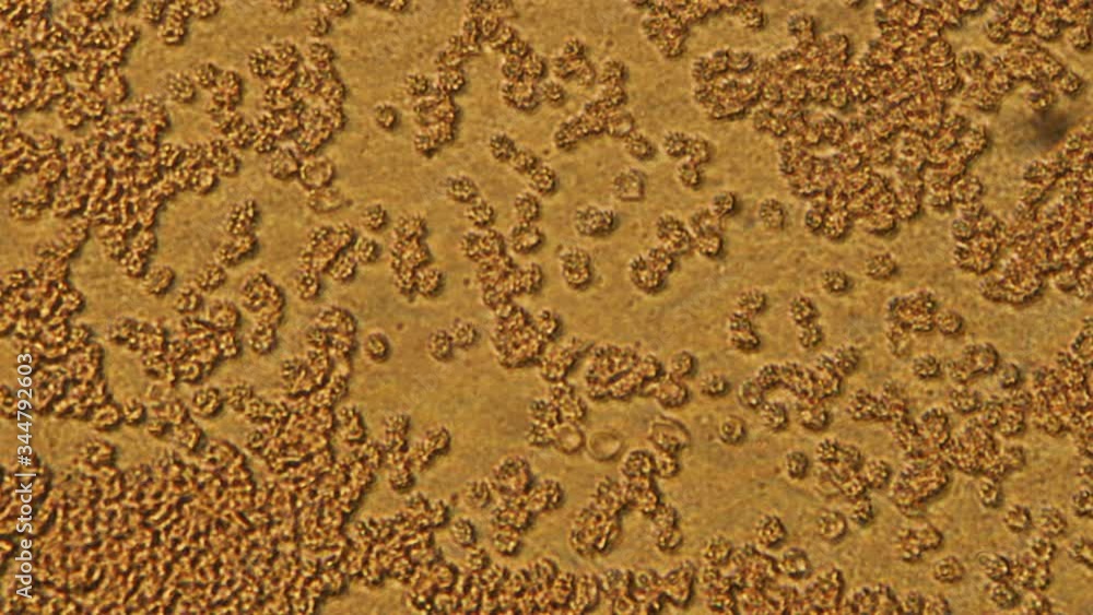 Microscopy of human blood cell test. Magnification 300x moving of red ...