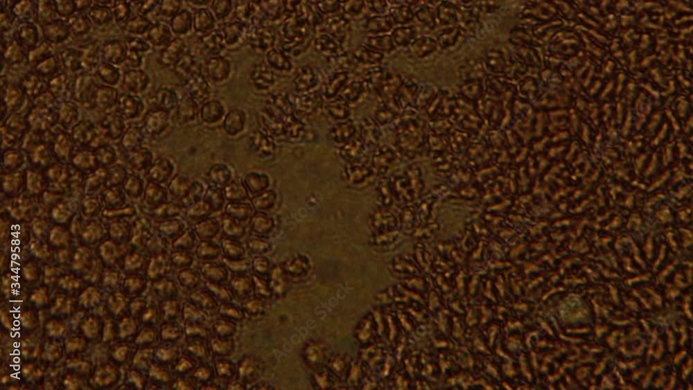Microscopy of human blood cell test. Magnification 600x moving of red ...