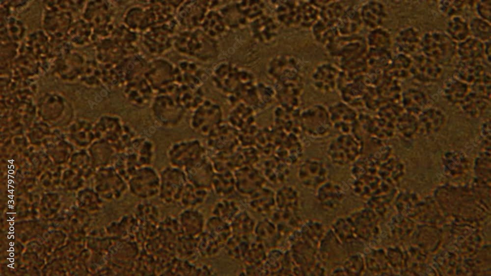 Microscopy of human blood cell test. Magnification 600x moving of red ...