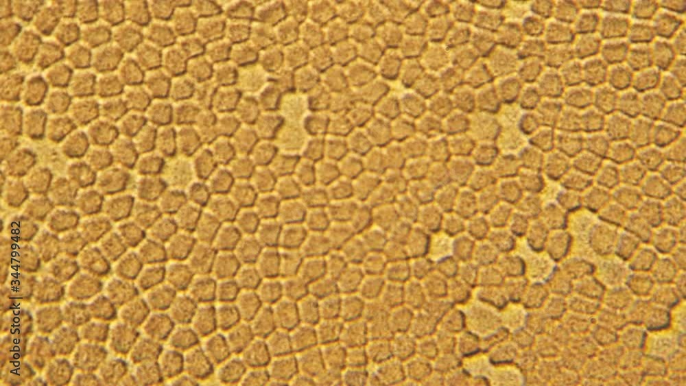 Microscopy of human blood cell test. Magnification 300x moving of red ...