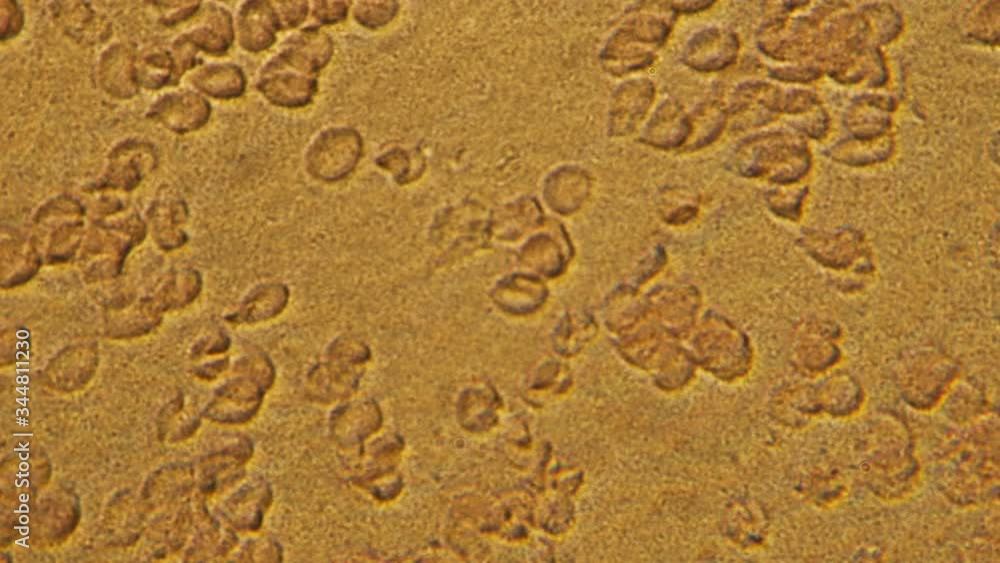 Microscopy of human blood cell test. Magnification 600x moving of red ...