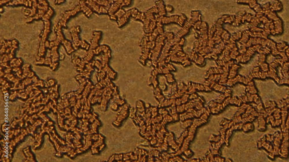 Microscopy of human blood cell test. Magnification 300x moving of red ...