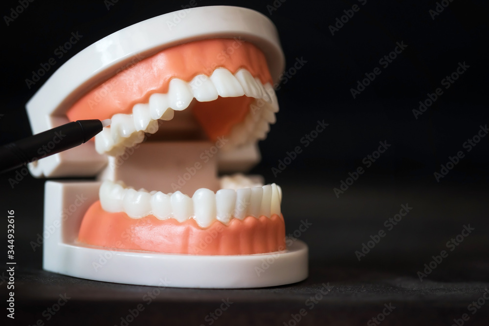 Dentist point pen to molar tooth. dental knowledge Stock Photo | Adobe ...