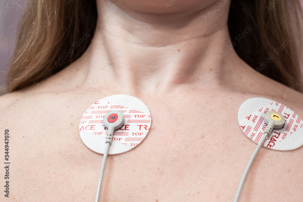 ECG electrodes on a woman chest Stock Photo | Adobe Stock
