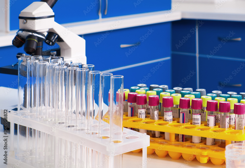 Laboratory interior, test lab, blood samples from patients with viral ...